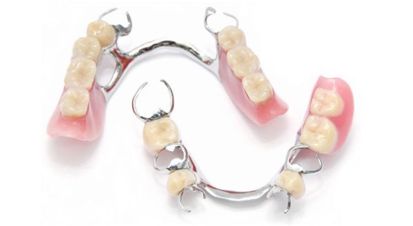Dentures in Penge, South East London | Accepting New NHS Patients