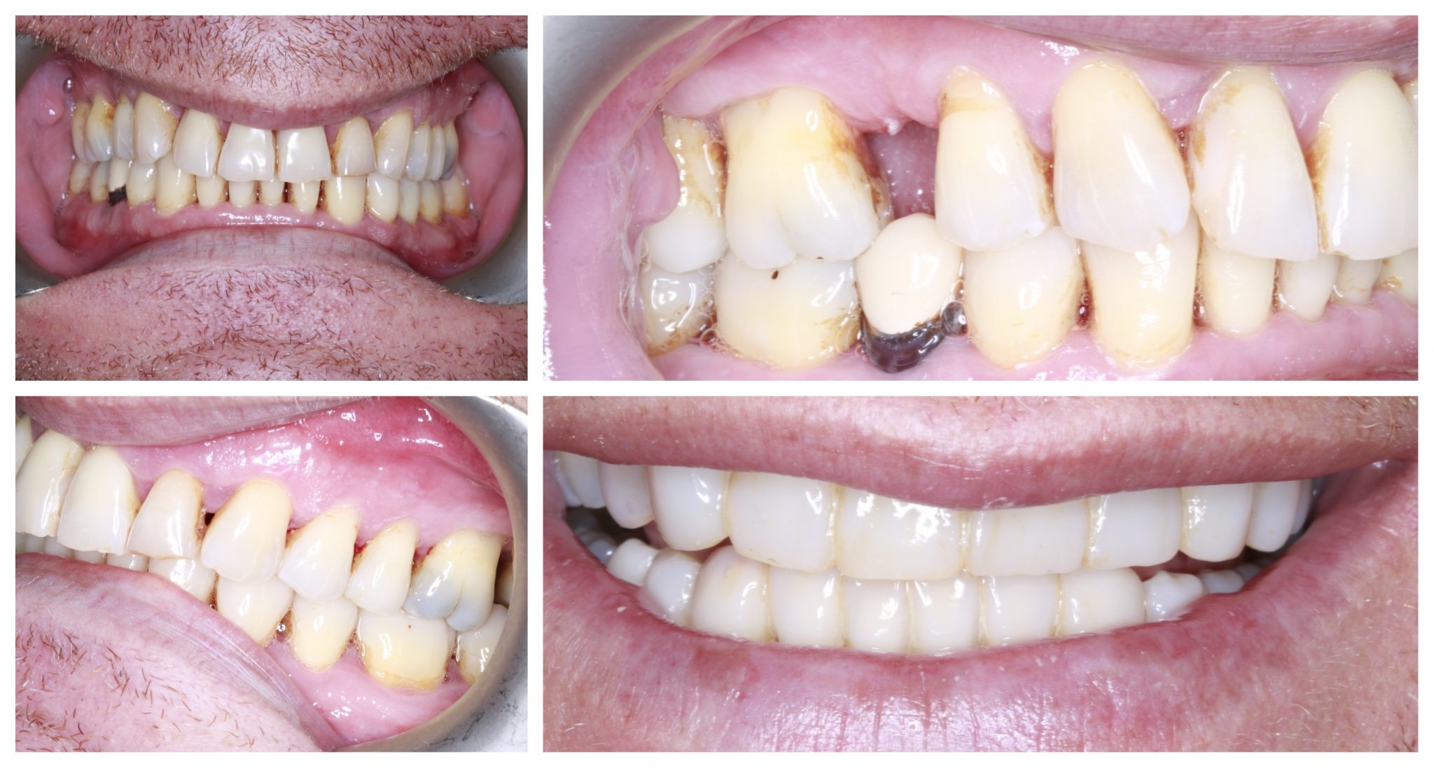 NHS Dentist in Penge, Bromley | Dentist Penge | Contact Us!