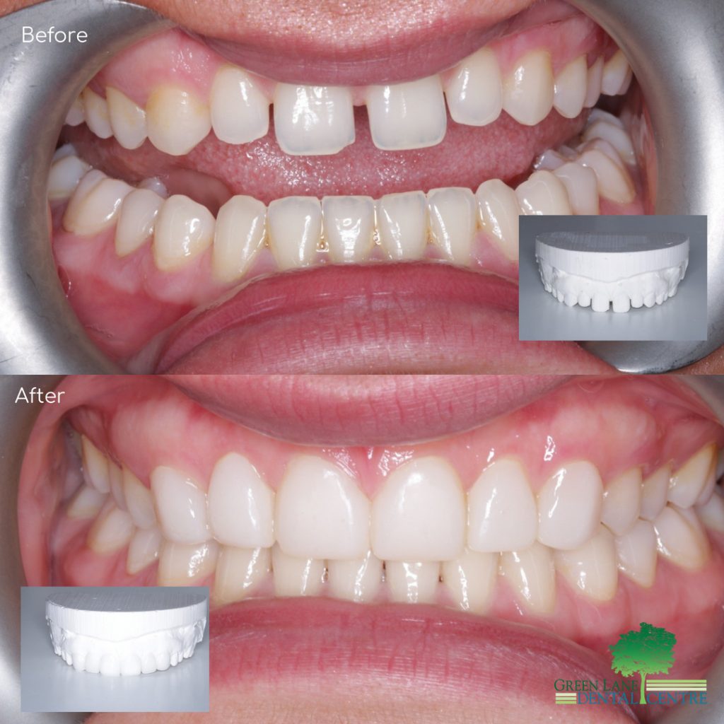 NHS Dentist in Penge, Bromley | Dentist Penge | Contact Us!