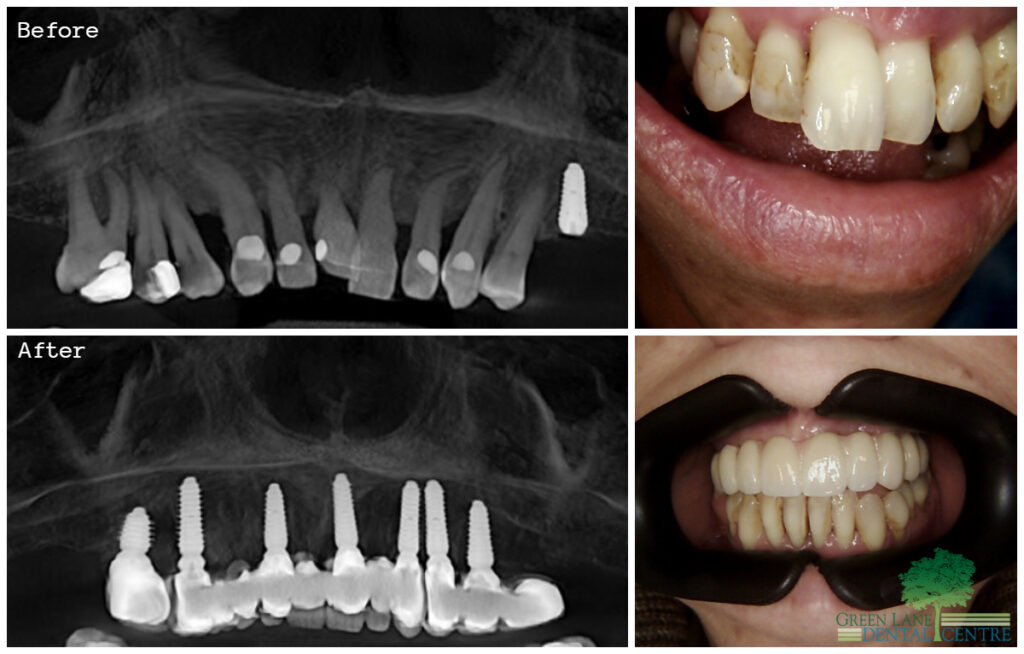 Smile Gallery | Green Lane Dental Centre | Penge, London SE20