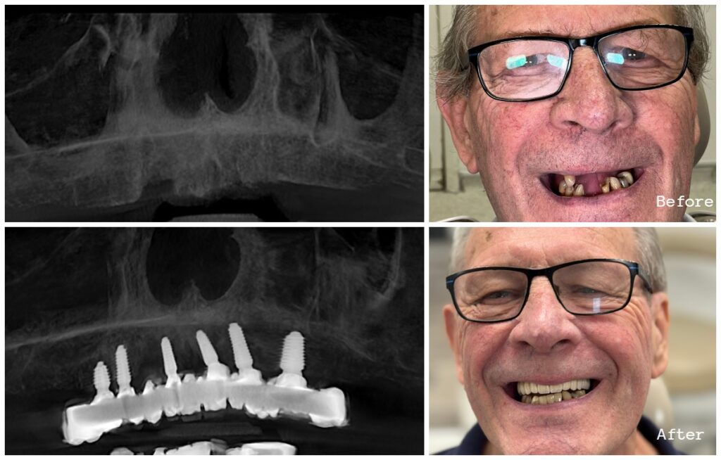 Smile Gallery | Green Lane Dental Centre | Penge, London SE20