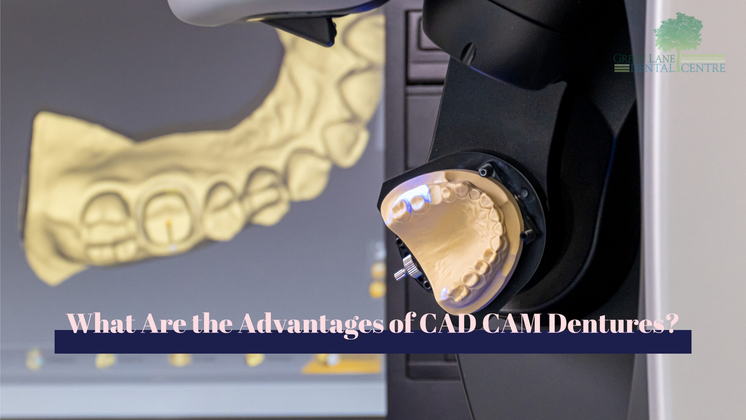 10 Benefits of CAD CAM Dentures: Advanced Comfort & Durability